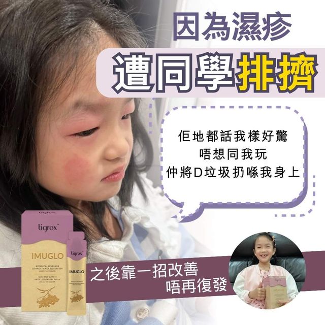 《限時優惠》 Tigrox™️ Imuglo 濕疹救星 正品正貨 | JustKidding 輕鬆養生專門店